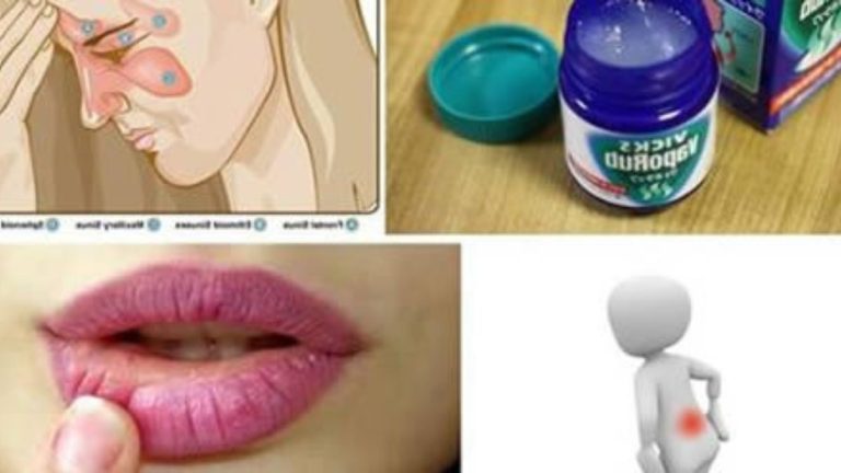 9 utilisations alternatives du Vicks VapoRub - Comment Conserver 9 utilisations alternatives du Vicks VapoRub - Comment Conserver